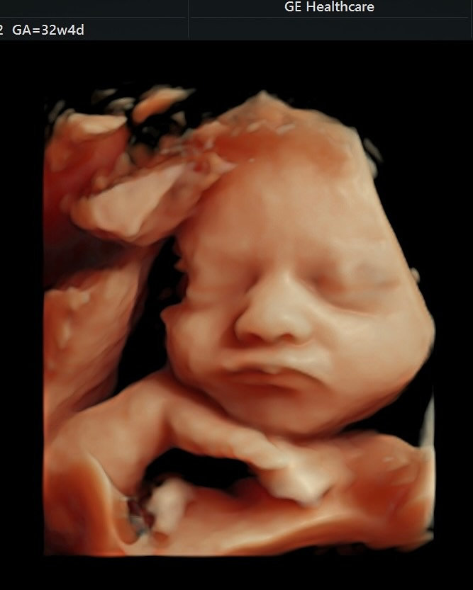 The Magic of 3D/4D Ultrasound - Jena Craig Photography